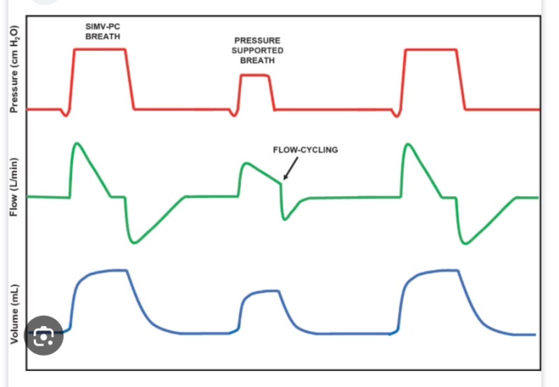 벤틸레이터 모드 - SIMV 공부하기 : 네이버 블로그