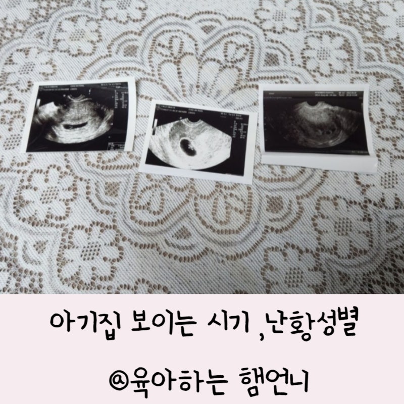 아기집 보이는 시기 난황 위치 성별 네이버 블로그