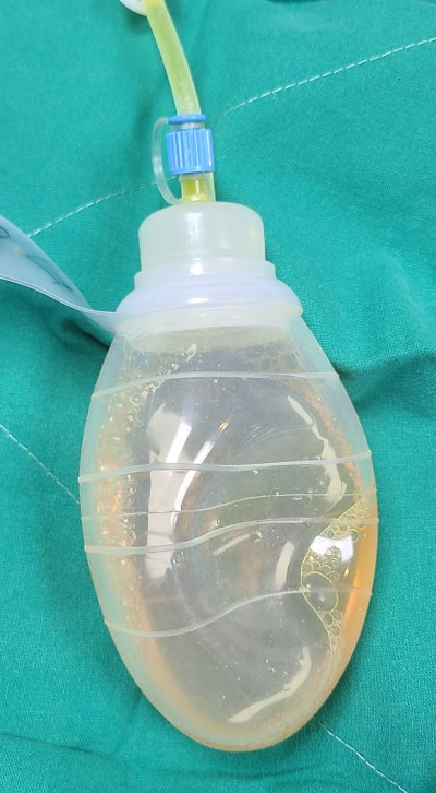 다양한 배액관의 종류와 주의사항 및 간호관리 : 네이버 블로그