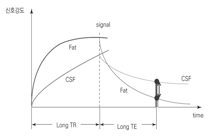 MRI medical physics (T1, T2, PD 강조영상) : 네이버 블로그