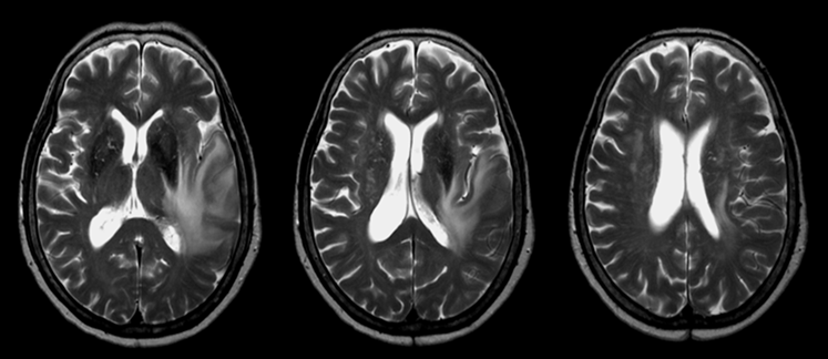 MRI medical physics (T1, T2, PD 강조영상) : 네이버 블로그