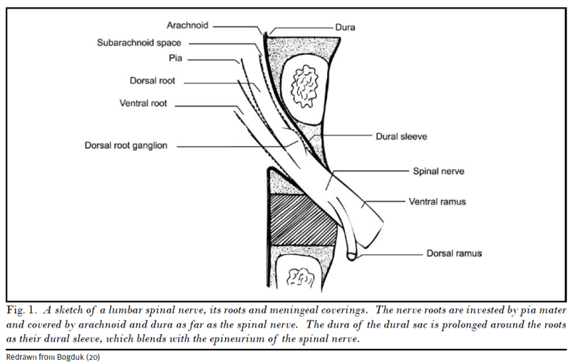 [외래/주사/척추]L-SNRB Selective Nerve Root Block /transforaminal block ...