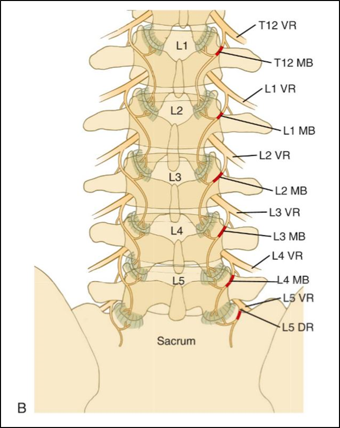 [외래/주사/척추]L-SNRB Selective Nerve Root Block /transforaminal block ...