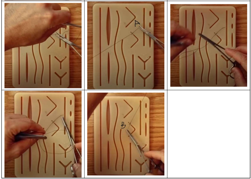 incision & suture 기본 : 네이버 블로그