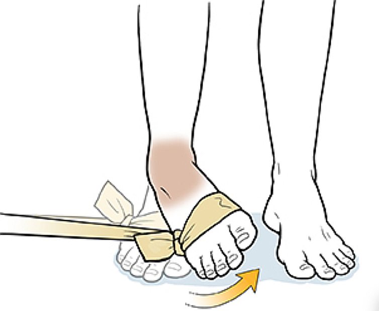 후경골근(뒤정강근, tibialis posterior) 강화를 통한 평발 교정 운동 5가지 : 네이버 블로그