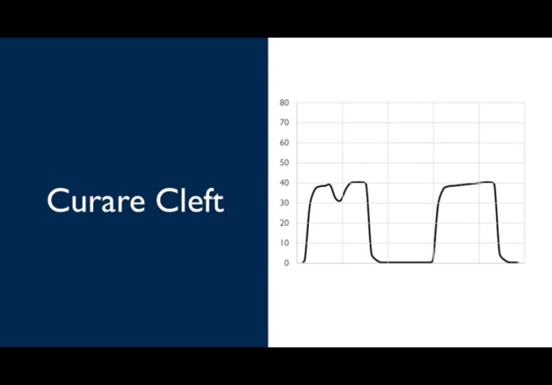 EtCO2 (Capnography 호기말 이산화탄소 분압) 공부하기 : 네이버 블로그