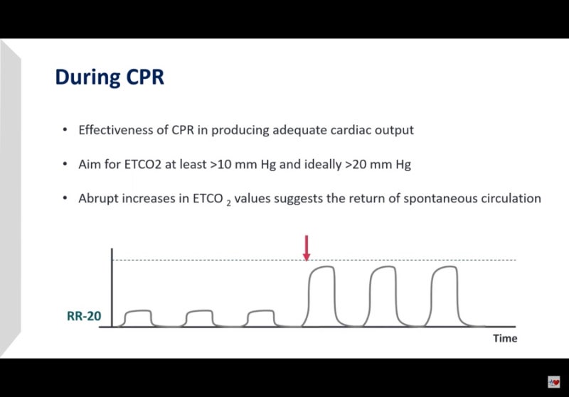 EtCO2 (Capnography 호기말 이산화탄소 분압) 공부하기 : 네이버 블로그