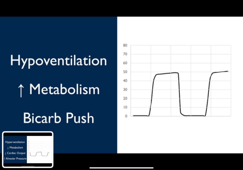 EtCO2 (Capnography 호기말 이산화탄소 분압) 공부하기 : 네이버 블로그