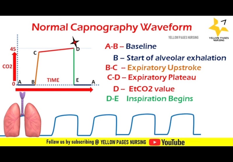 EtCO2 (Capnography 호기말 이산화탄소 분압) 공부하기 : 네이버 블로그