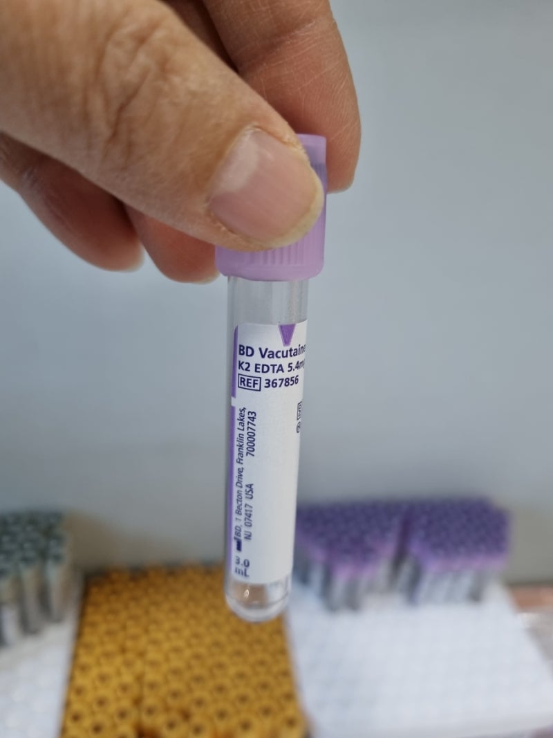 채혈 시 Bottle 담는 순서 및 CBC, LFT 보틀 검사항목 : 네이버 블로그