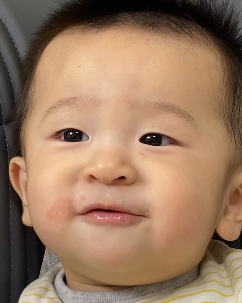 아기 침독크림 제로이드크림 샘플받기 제로이드 병원 처방 전 꿀팁 안양 평촌 봄빛병원 네이버 블로그