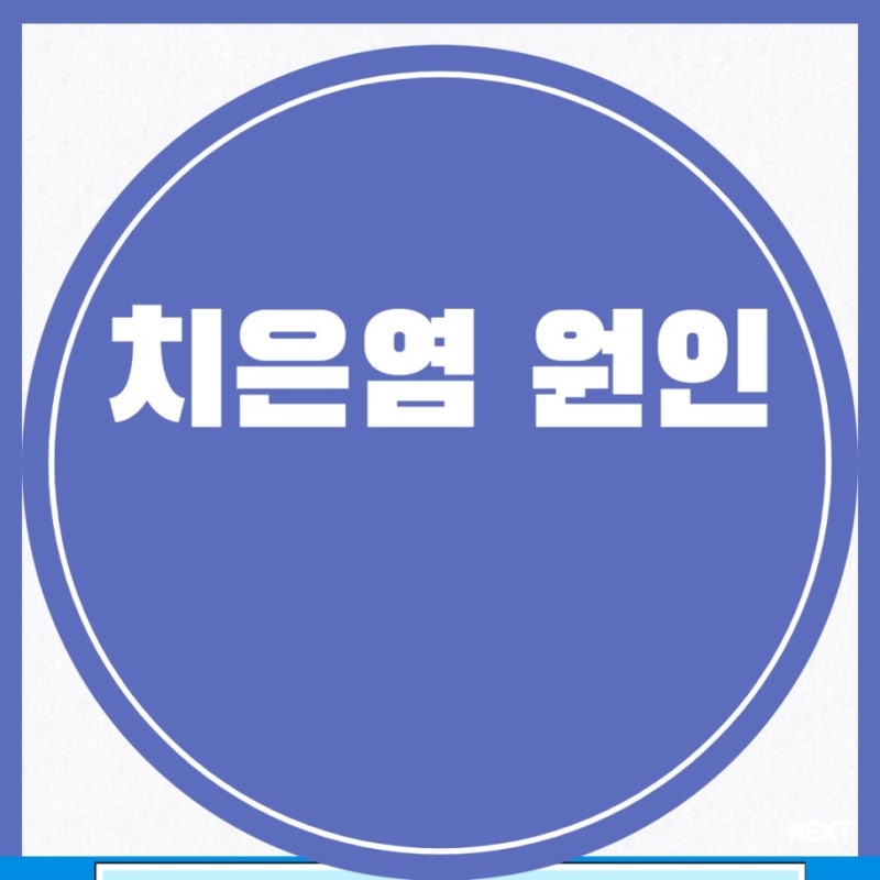 잇몸 염증 치은염 원인 증상 치주염 진단 치료 치주질환 네이버 블로그