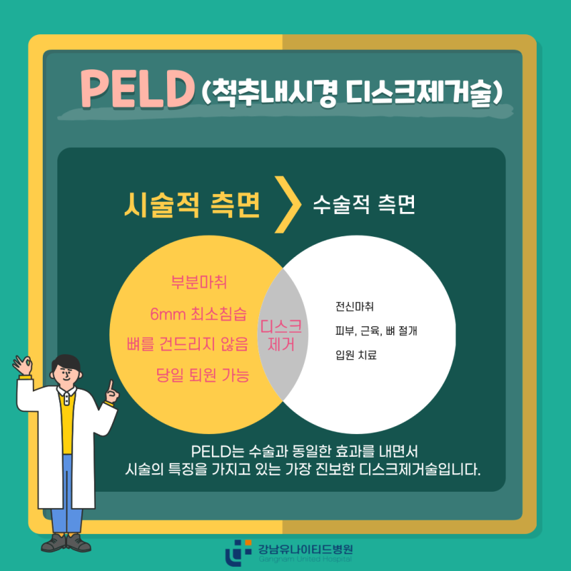 PELD는 시술인지 수술인지 궁금해요 : 네이버 블로그