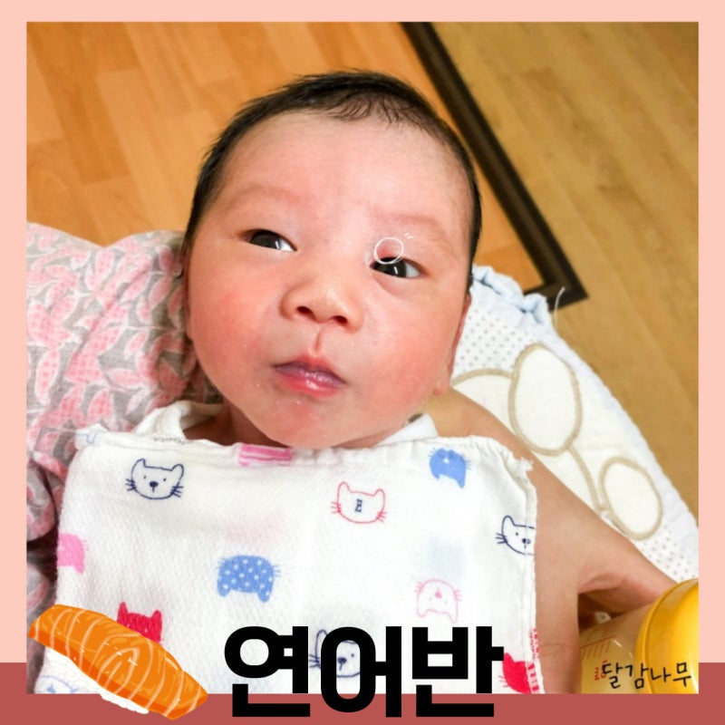 신생아 연어반 원인 없어지는 시기 아기 얼굴에 붉은 반점 빨간점 네이버 블로그