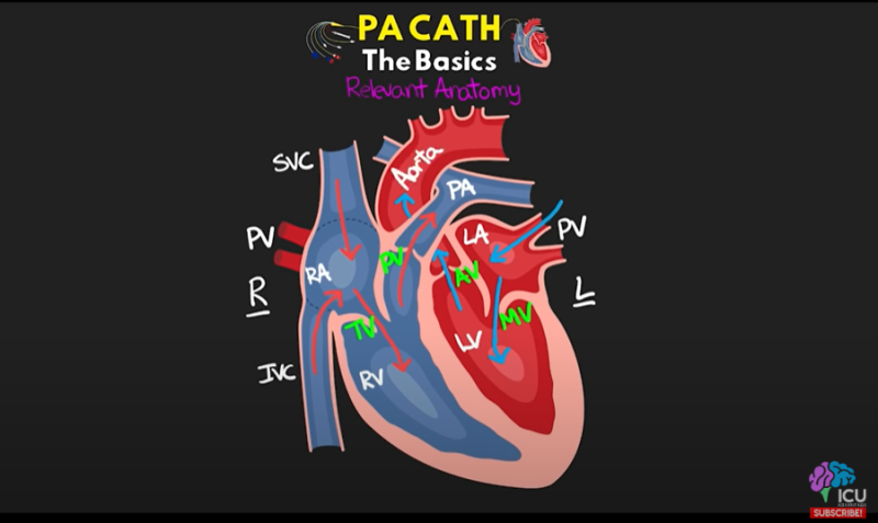Swan ganz catheter(1) PA(Pulmonary Artery) catheter란, 심장의 구조와 PAC의 4가지 ...