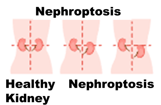 학생간호사를 위한 의학용어- 수술•시술 절차의 접미사 이해하기 : 네이버 블로그