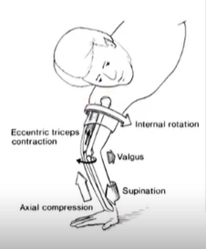 [정형외과 전문의] 팔꿈치 관절의 불안정성, 탈구 (elbow dislocation, PLRI, PMRI, fracture ...