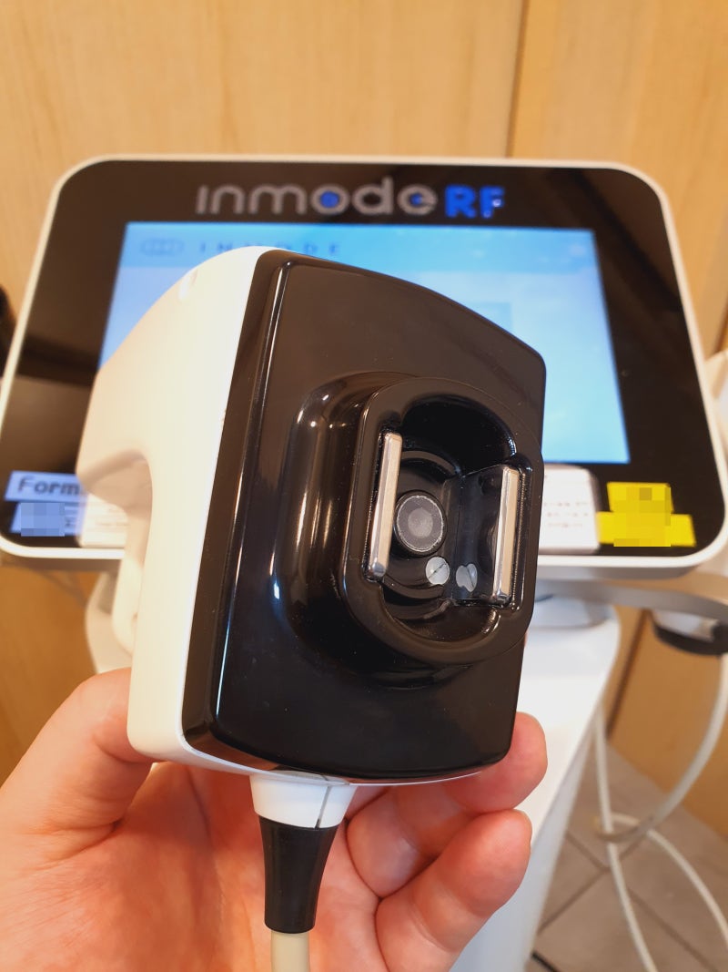 #35.인모드 fx 리프팅 효과 시술일기!시술 전후 case 소개,이중턱 턱라인 정리의 여전한 first choice ...