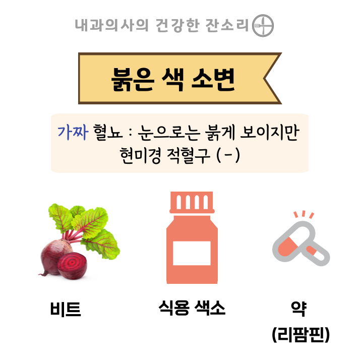 소변에서 혈뇨 나왔다면 혈뇨원인 증상 남자 여자 나이에 따라 다르다 네이버 블로그