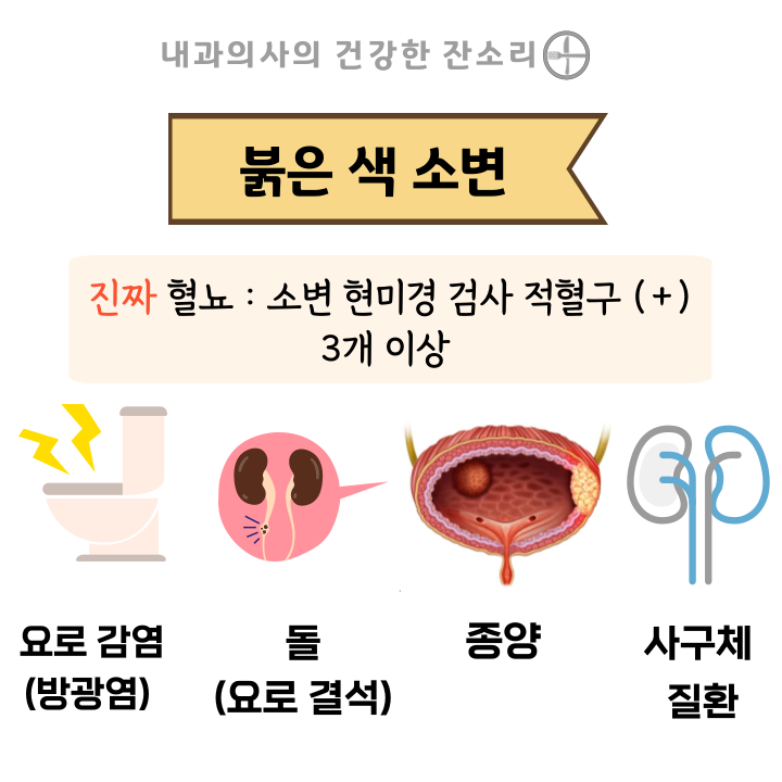 소변에서 혈뇨 나왔다면 혈뇨원인 증상 남자 여자 나이에 따라 다르다 네이버 블로그