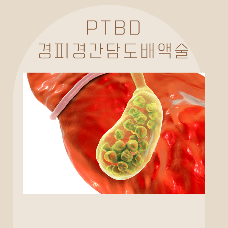 의학용어 PTBD & PTGBD 목적 차이점 이럴 땐 노티 : 네이버 블로그