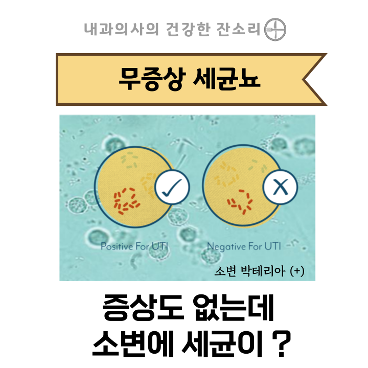 소변 염증 백혈구 있다 증상도 없는데 치료를 받아야 하나요 무증상 세균뇨 네이버 블로그