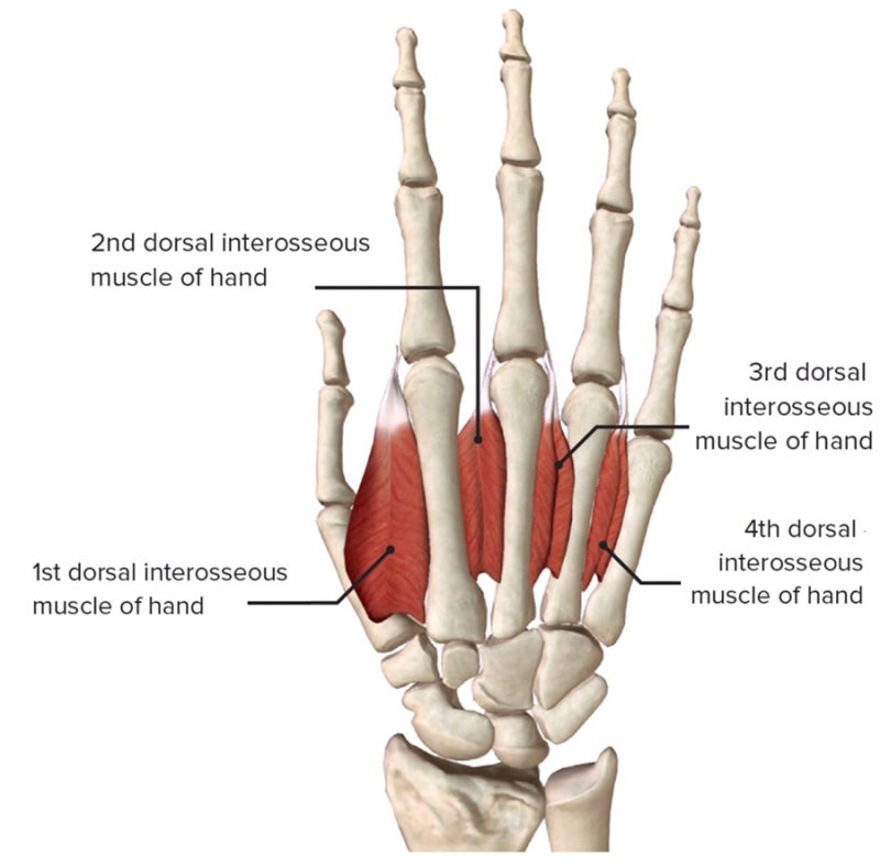 뉴만 키네시올로지 대신 공부해드립니다 23 ~p353 Ulnar Deviation 백조목변형 단추구멍변형 네이버 블로그