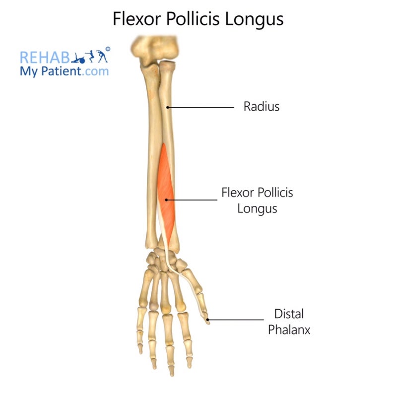 뉴만 키네시올로지 대신 공부해드립니다 23 ~p353 Ulnar Deviation 백조목변형 단추구멍변형 네이버 블로그