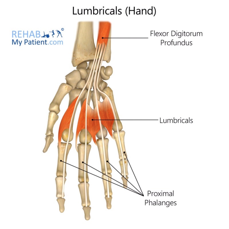 뉴만 키네시올로지 대신 공부해드립니다 23 ~p353 Ulnar Deviation 백조목변형 단추구멍변형 네이버 블로그