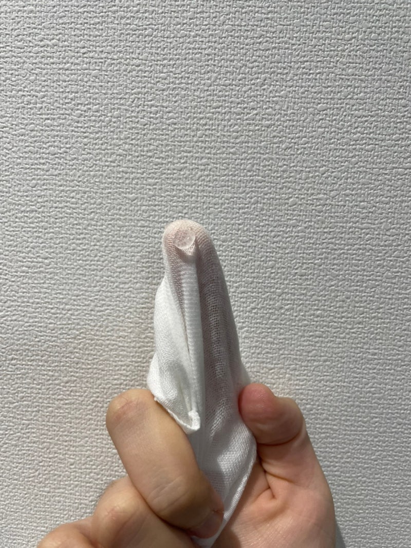 3개월 아기 양치 언제부터 불소치약 불소도포가능 소아청소년과 네이버 블로그