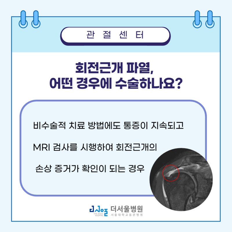 어깨 수술 잘하는 병원, 회전근개 파열 '관절내시경'으로 치료 : 네이버 블로그