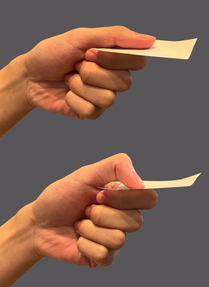 뉴만 키네시올로지 대신 공부해드립니다 23 ~p353 Ulnar Deviation 백조목변형 단추구멍변형 네이버 블로그