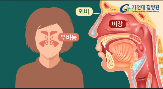 호랑이약국 오트리빈종류 오트리빈베이비 오트리빈소아용 오트리빈멘톨 오트리빈에스 오트리빈차이 송도오트리빈 비염스프레이