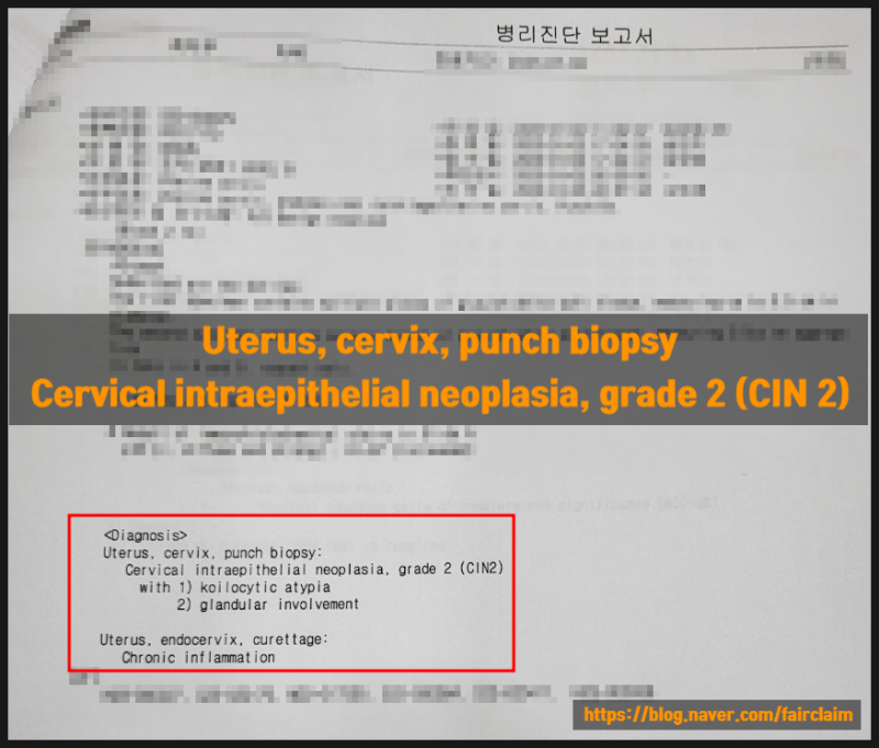 자궁경부의 상피내신생물 분화도2n871으로 제자리암 진단비 지급 받은 사례 네이버 블로그