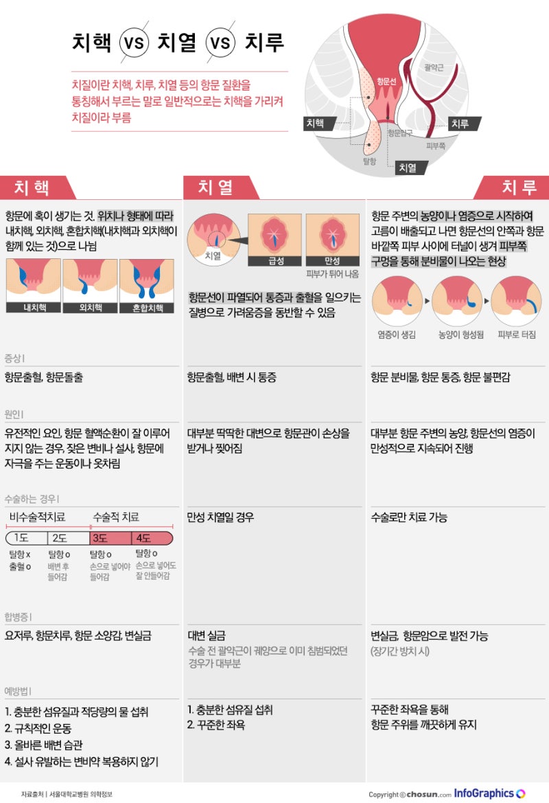 약사가 알려주는 푸레파인 연고 치질 치질연고 부종 출혈 가려움 통증 치열 치핵 사용방법 주의사항 가격