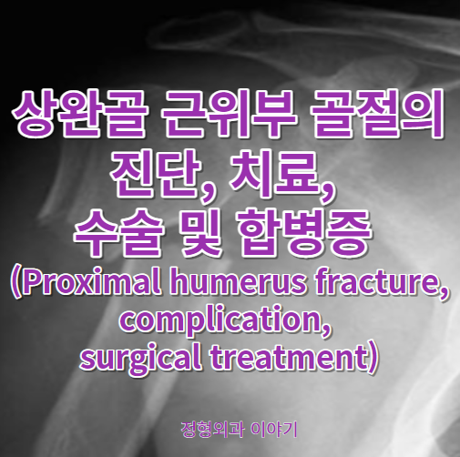 정형외과 전문의 근위 상완골 골절의 치료 합병증 Treatment Of Proximal Humerus Fracture