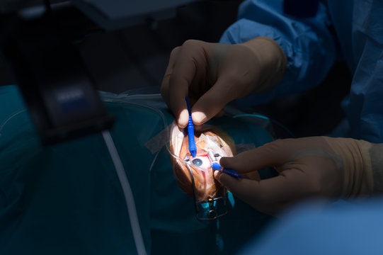 망막박리 원인 치료 수술 성공률 공막돌륭술과 유리체절제술 네이버 블로그