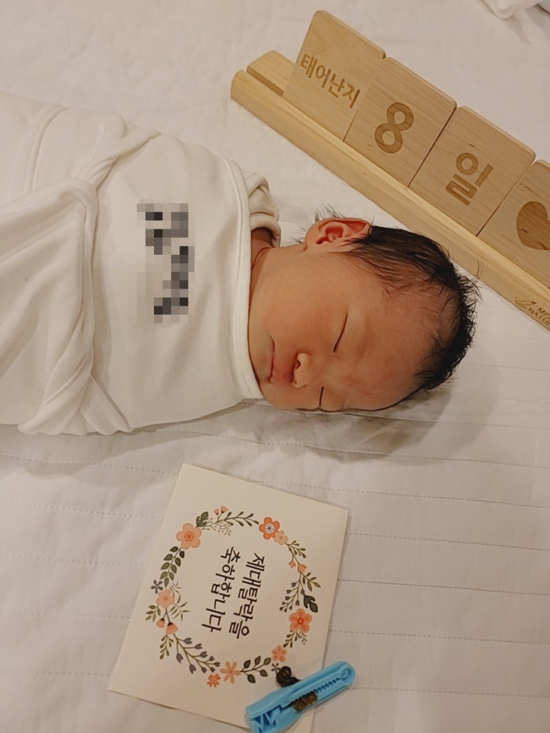 신생아 배꼽 떨어지는 시기 탯줄 일찍 떨어지거나 늦게 떨어지면 어떻게 할까 네이버 블로그