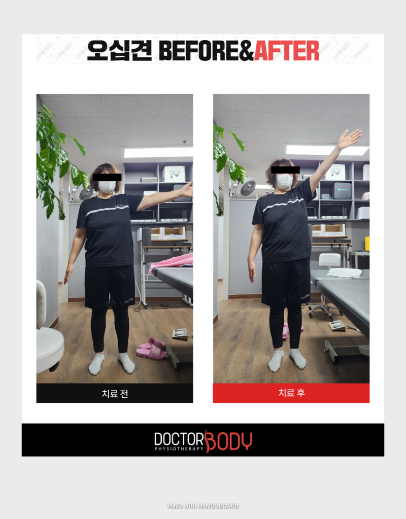 부산 오십견 병원 추천 동래어깨병원도수치료어깨통증오십견재활전문 네이버 블로그