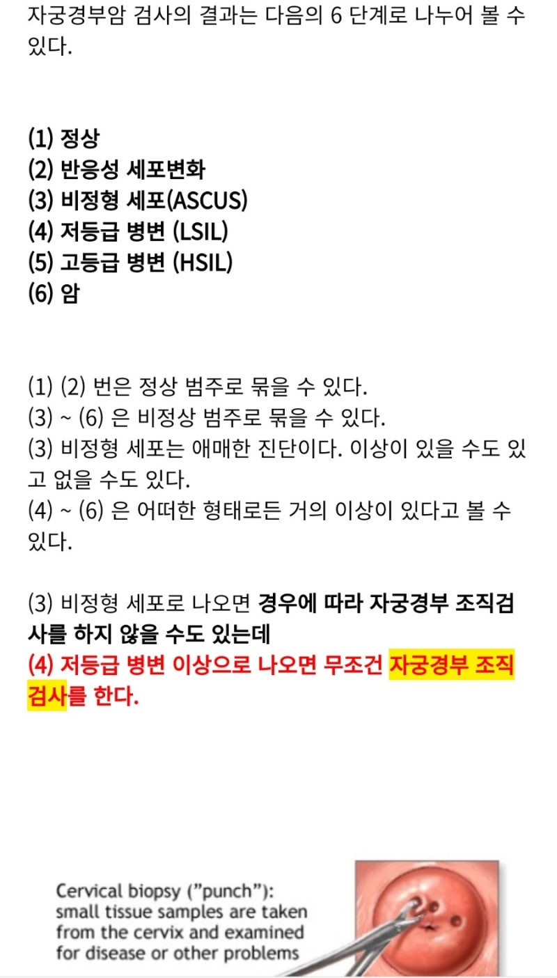 자궁경부암 검진 자궁내막용종폴립 자궁확대촬영검사 원추절제술 가다실9 네이버 블로그