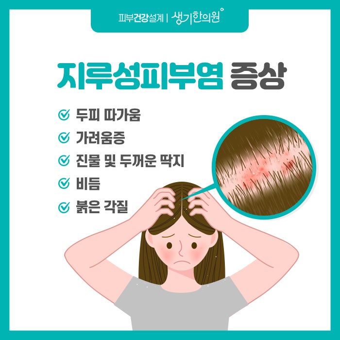 얼굴과 두피에 생긴 노원지루성피부염맞춤 치료의 중요성 네이버 블로그