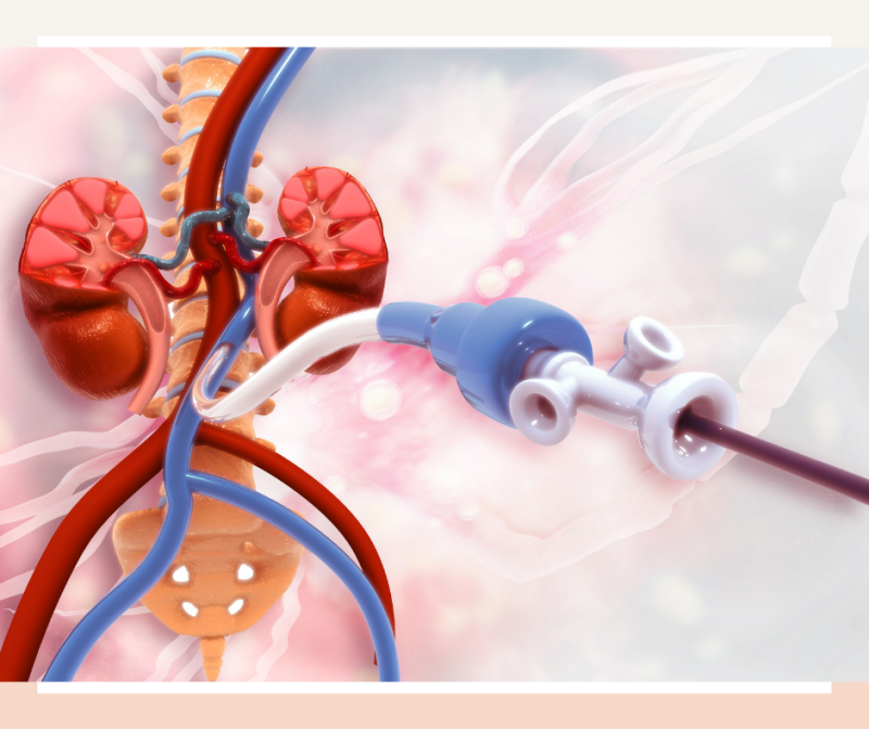 의학용어 AVF 동정맥루 thrill 체크 및 간호 : 네이버 블로그