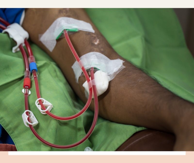 의학용어 AVF 동정맥루 thrill 체크 및 간호 : 네이버 블로그