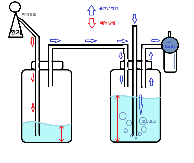 CTD : Chest Tube Drainage의 bottle 이해하기, Chest Bottle A Type-C type, CTD ...