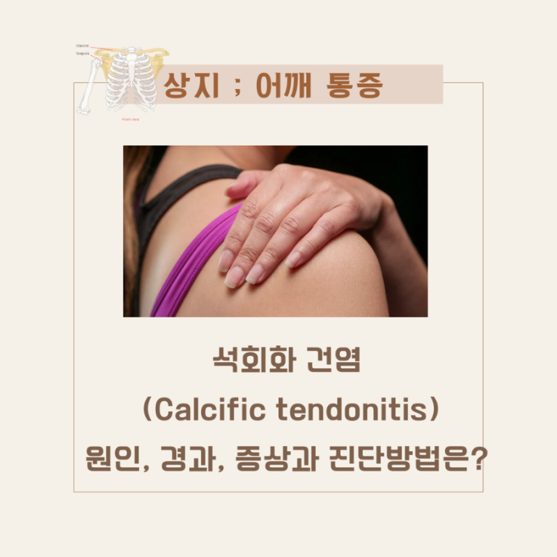 어깨의 석회화 건염 Calcific Tendinopathy의 원인과 경과 과정 증상과 진단 방법 1 네이버 블로그