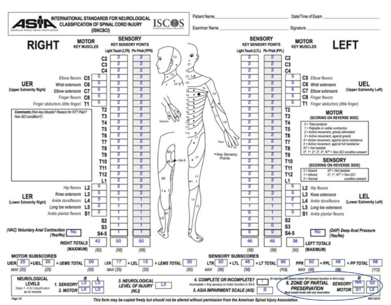 ISNCSCI 8 edition 샘플 케이스 : 2015, 2019 업데이트 버전 : 네이버 블로그