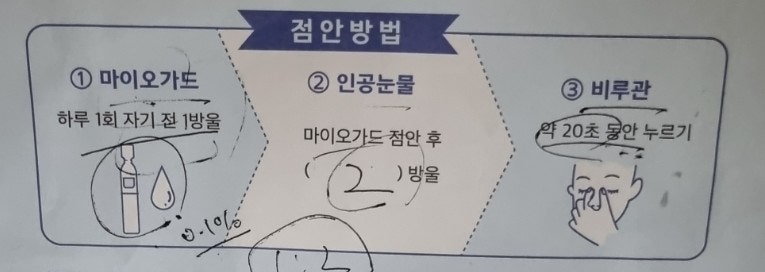 초등학생 근시교정 근시 약물치료 마이오가드 드림렌즈 드림렌즈 일주일 적응기간 후기 네이버 블로그