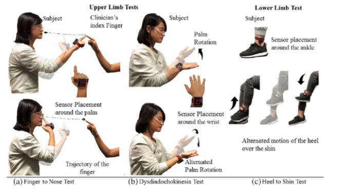 #뇌졸중(Stroke)3편_신경학적 검사 Neourological Exam (N/Ex) :GCS사정, pupil사정,소뇌 검사 ...