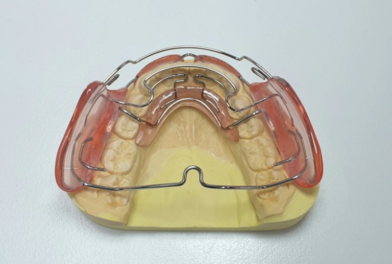 Frankel appliance/Function Regulator : 네이버 블로그