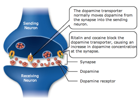 소아 ADHD(Overview of Attention Deficit Hyperactivity Disorder) : 네이버 블로그